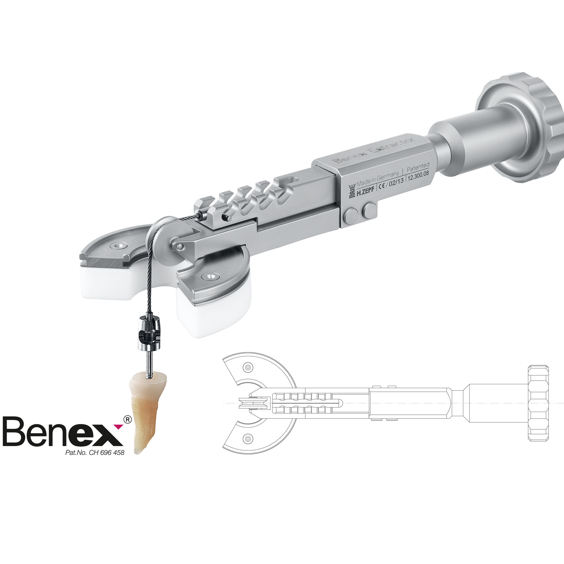 Benex® Extraction System