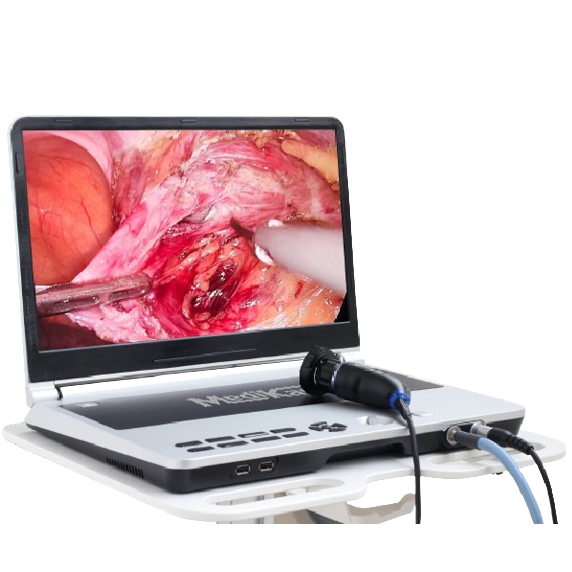 Endoscopy Camera System